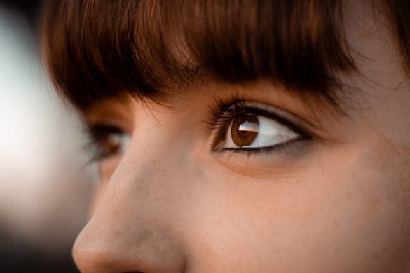 How To Cover Up & Hide Raised Moles (With or Without Makeup)